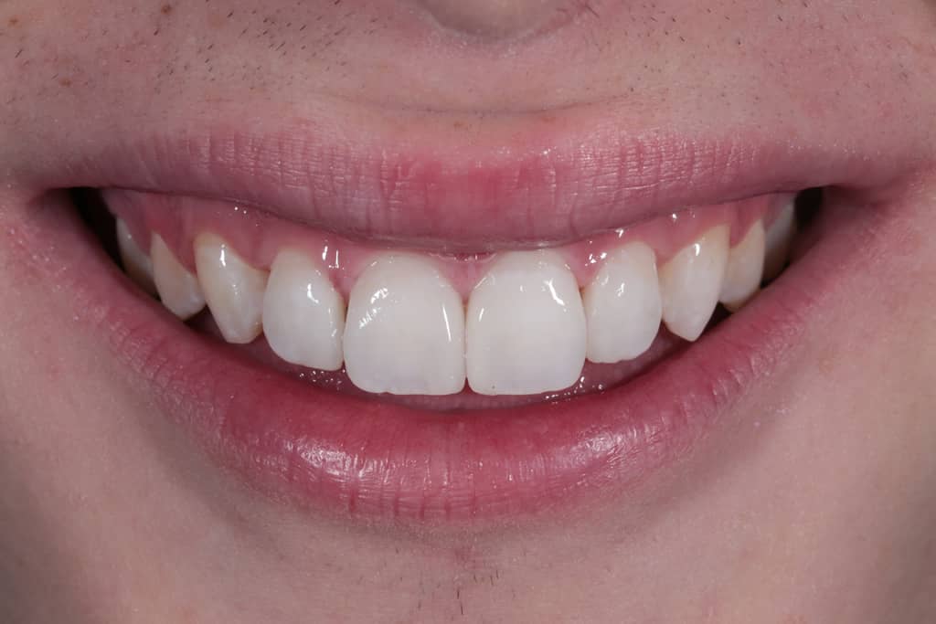 ADAM - Dr Monik Vasant - Award Winning Dentist